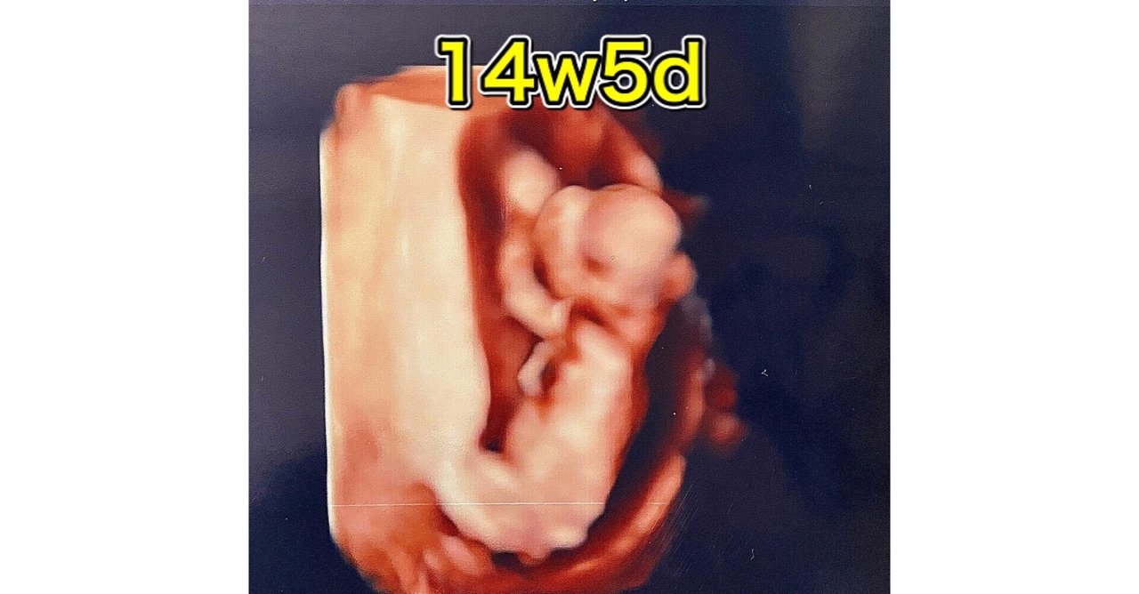 妊婦検診② お腹の中から存在感を感じた日｜みちっくす@2021年4月10日出産予定！プレママ