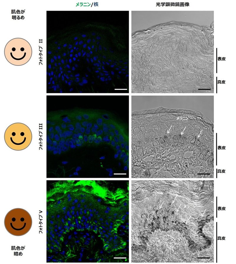 世界初、ヒト皮膚組織内のメラニン色素を蛍光で可視化_（株）コーセー｜女性モード社／美容師向け専門出版社