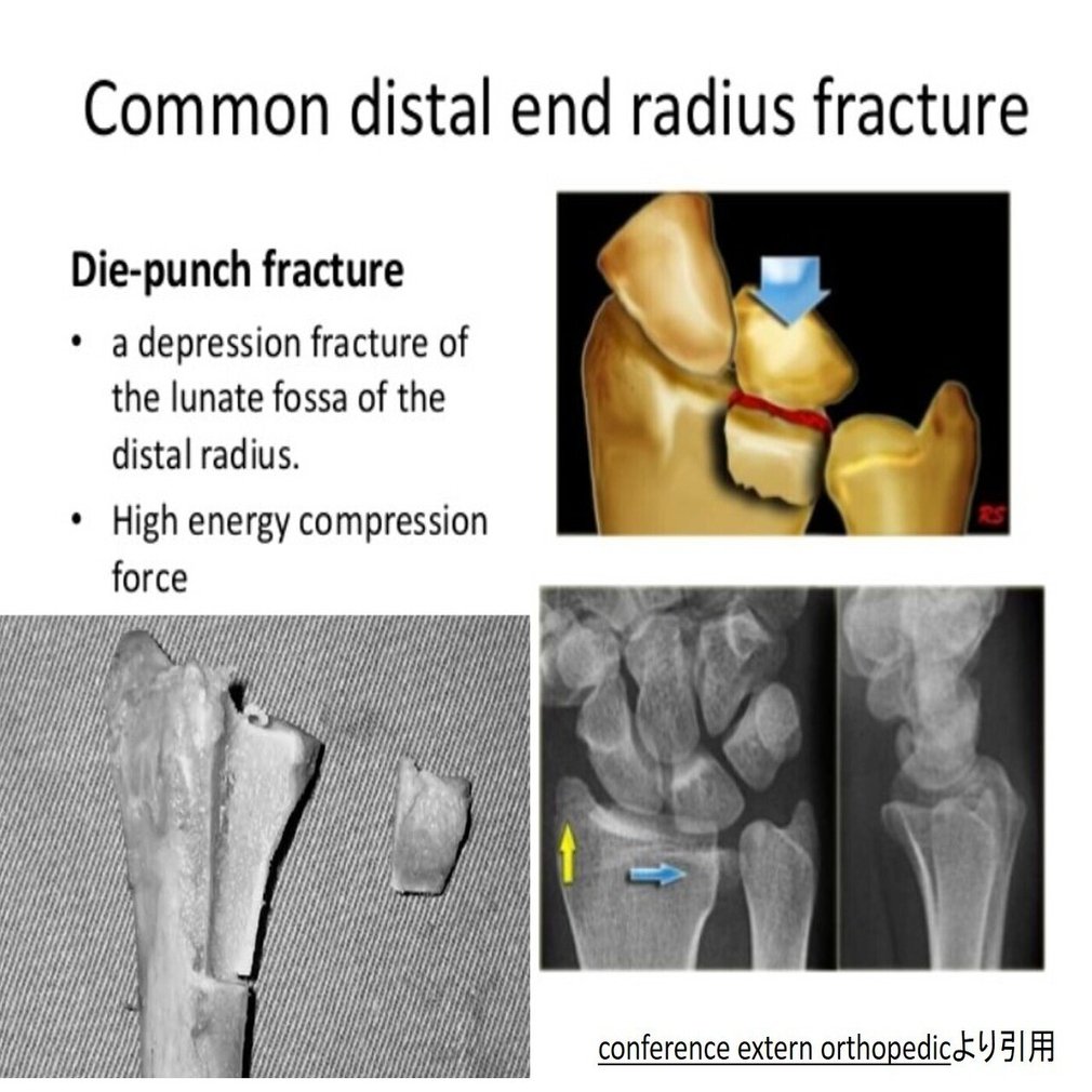 Die Punch Fracture