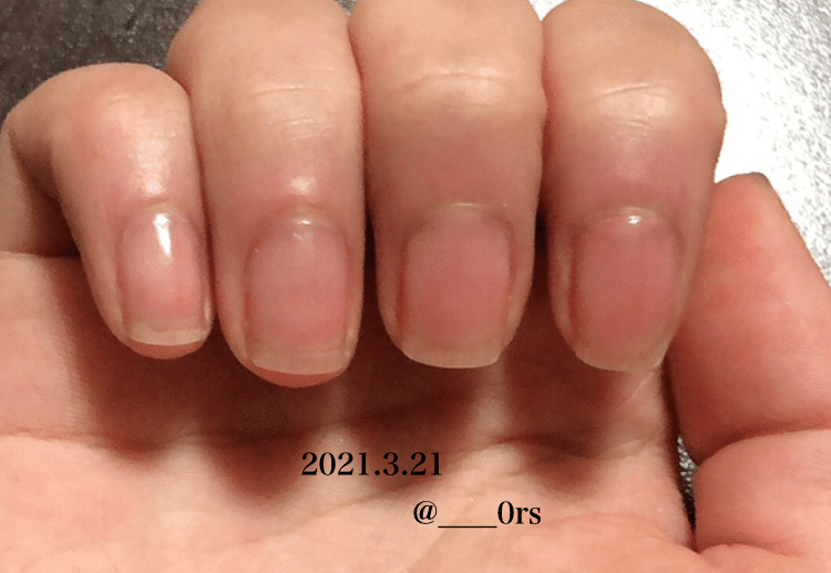 セルフケアでも爪は綺麗になる｜冷水｜@____0rs