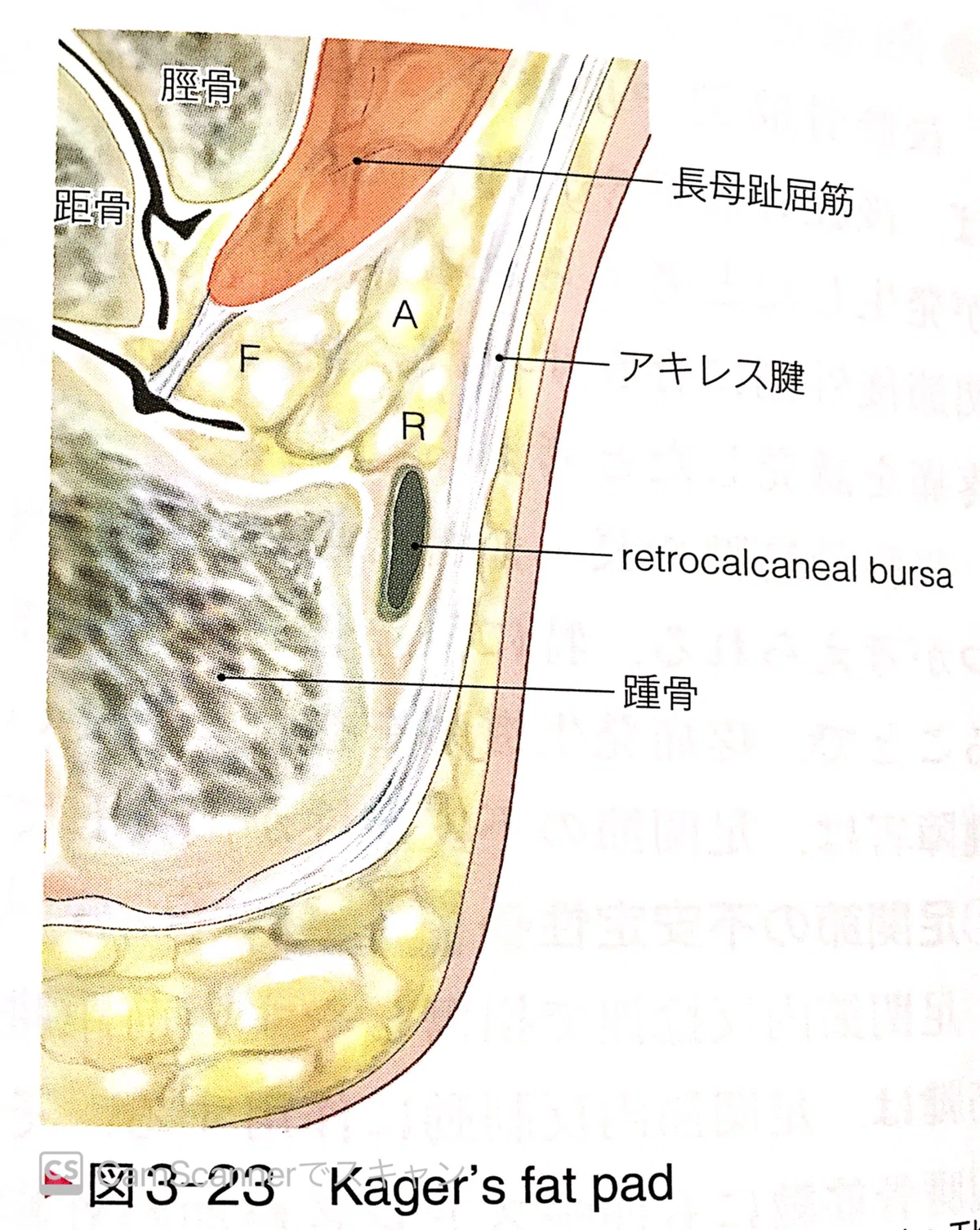 Kager's fat pad｜岩瀬勝覚