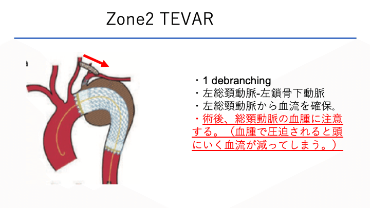 循環器疾患 看護師勉強会#2 TEVAR｜Masayuki Nishiyama