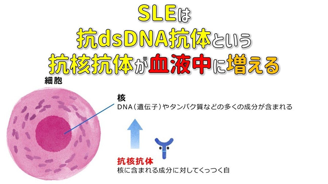 メモ【#SLE #抗dsDNA抗体】 抗核抗体 細胞の核と反応する自己抗体の総称 SLE患者は血液検査において 抗核抗体”陽性” （他の免疫 ...
