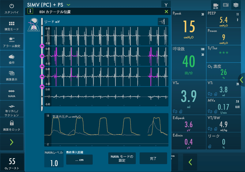 NAVA 導入・基礎編｜あかちゃんまん