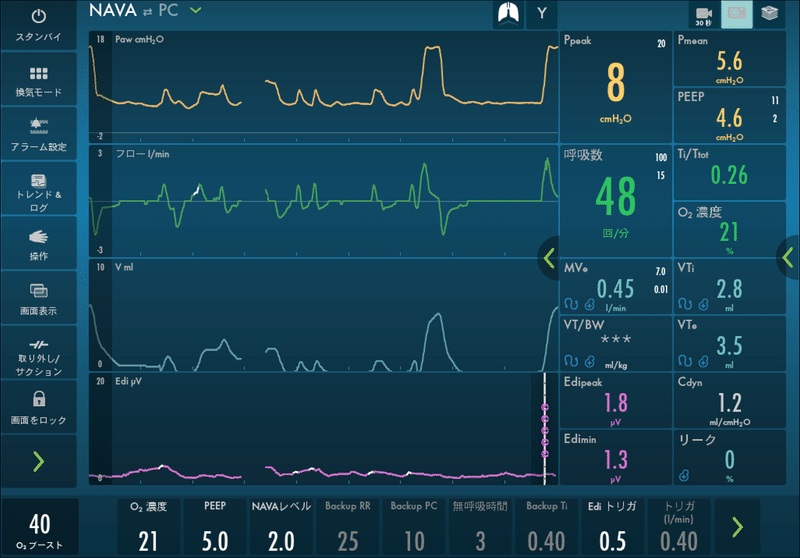 NAVAで起きるトラブルと対処｜あかちゃんまん