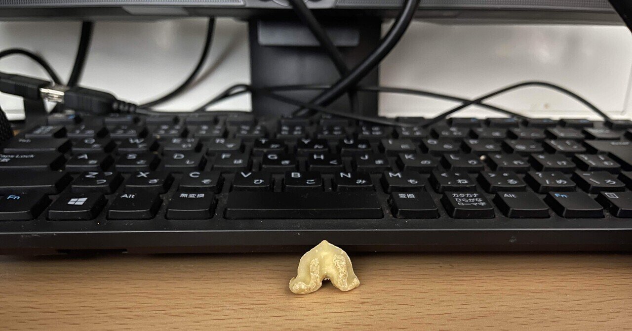 王様の髭🥸＊2022＊004｜Tenma Aida(patsukin)｜note