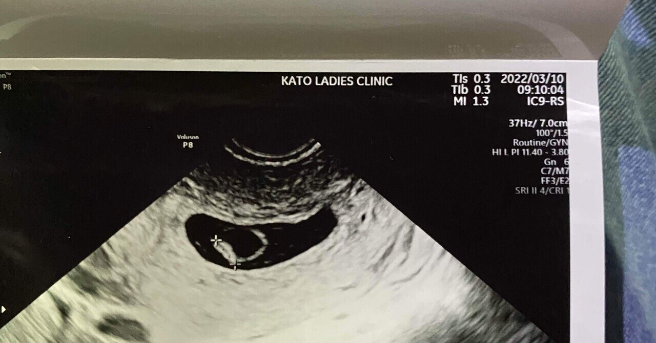 9w6dの奇跡｜ハチ