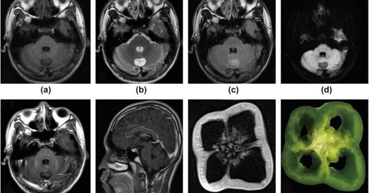 green bell pepper sign｜TKG画像診断