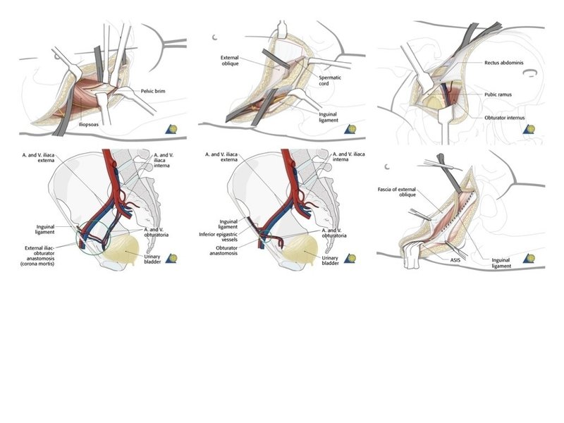 タイのキャダバーへ行ってました｜awaodori