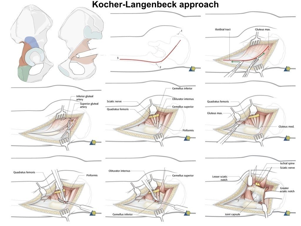 タイのキャダバーへ行ってました｜awaodori
