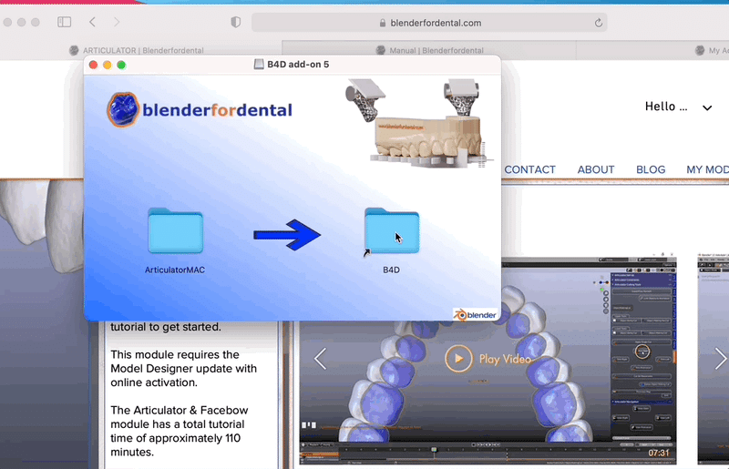 本格的CADソフトを買い切り低価格で！B4Dソフトウェア③モジュールの追加方法（咬合器・ワックスアップモジュールの追加方法）｜3D歯科
