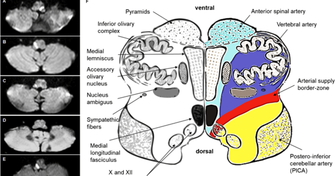 the comma-shaped sign｜TKG画像診断