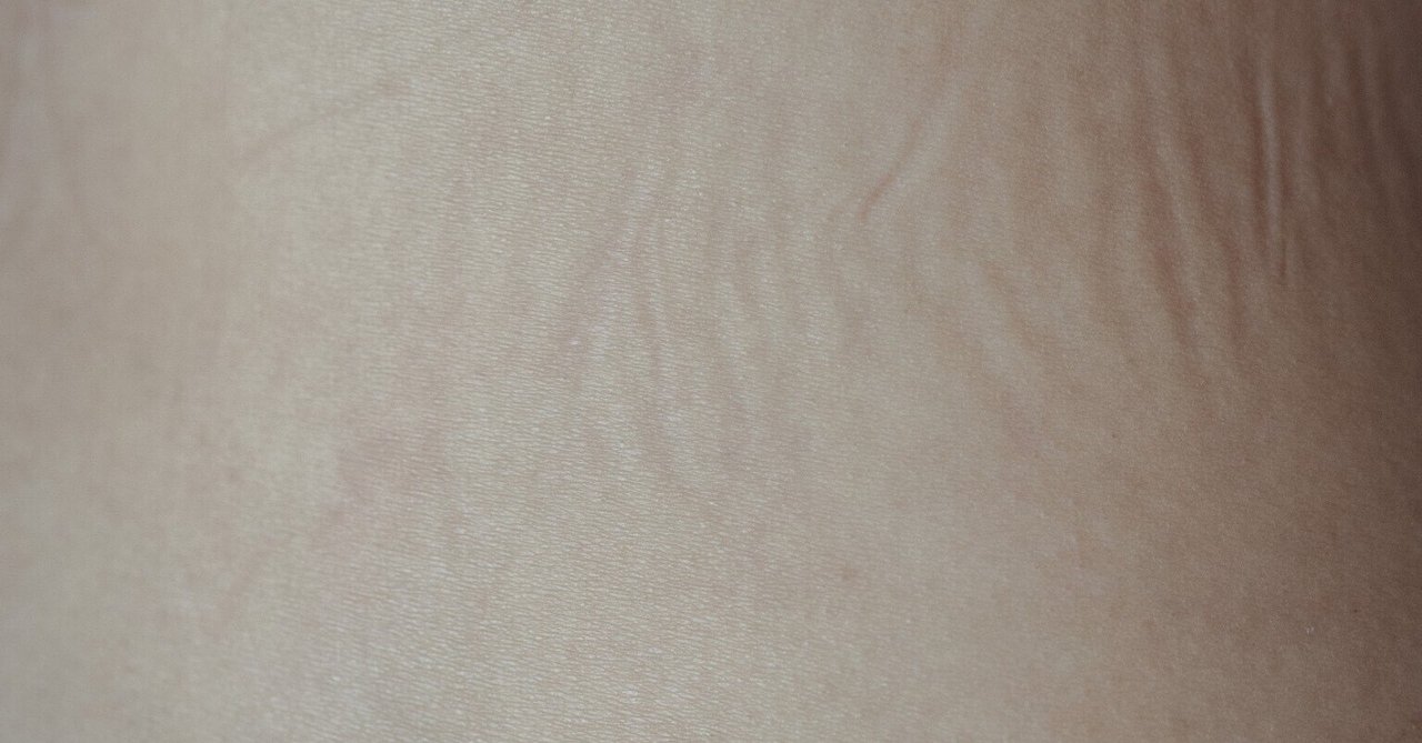 あの肌色｜manimanium｜note