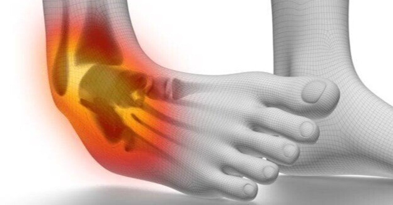 足首捻挫リハビリ【急性炎症回復期】｜nakaba_ueno｜note