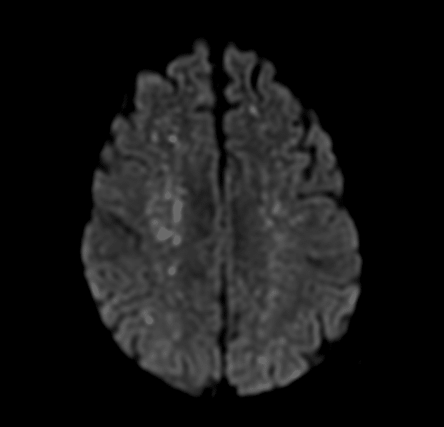 Starfield pattern｜TKG画像診断