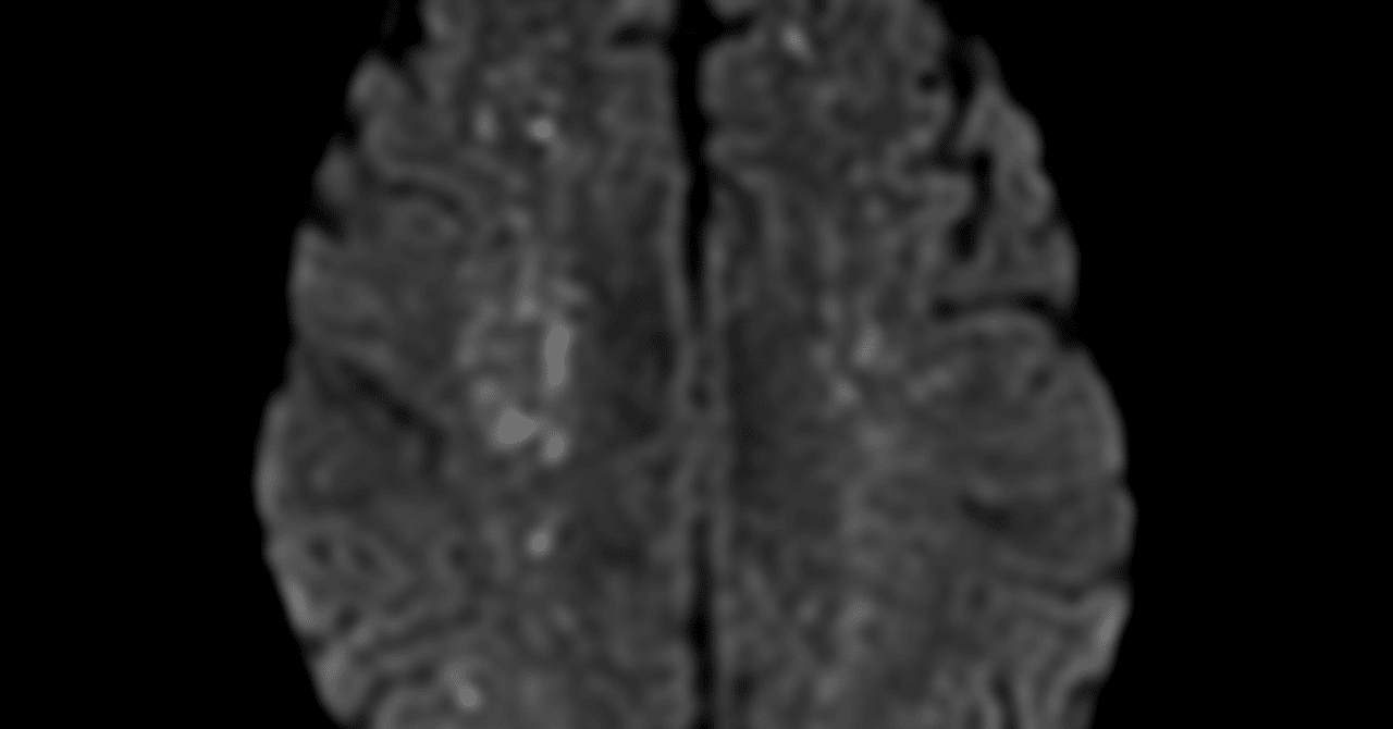 Starfield pattern｜TKG画像診断