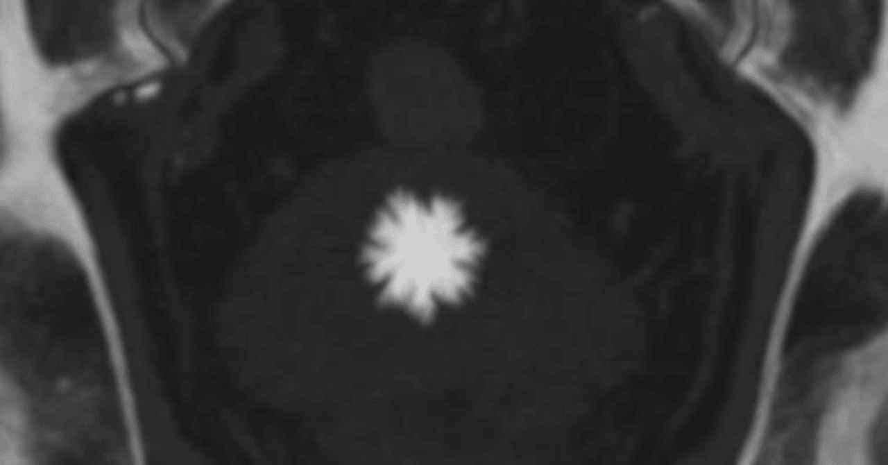 Jackstone結石｜TKG画像診断｜note