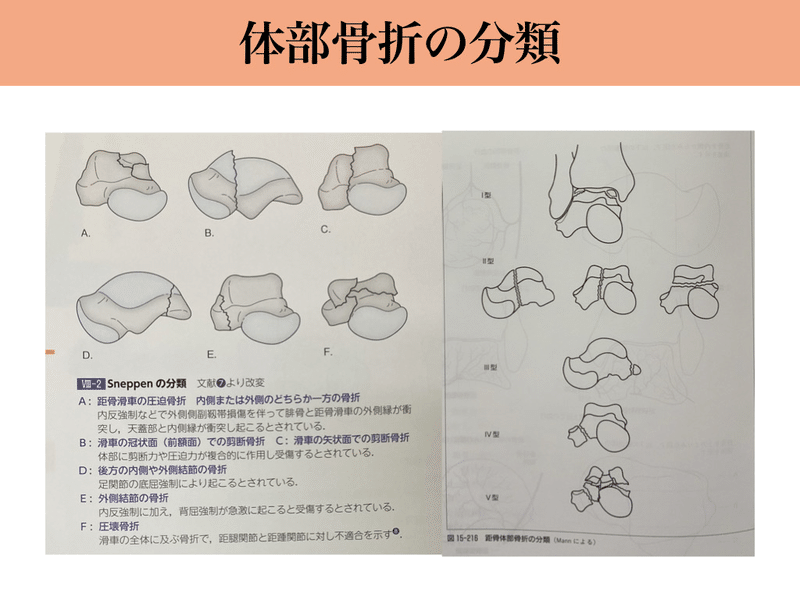 「距骨後突起骨折」＃書く習慣80｜整形外科で働く柔道整復師